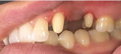 Advances in Dentistry and Oral Health (ADOH)